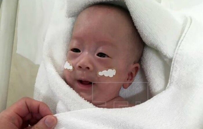 Cel mai mic copil prematur din lume reuşeşte să supravieţuiască